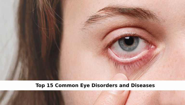 Top 15 Common Eye Disorders and Diseases - Dr. Maid Multispeciality ...